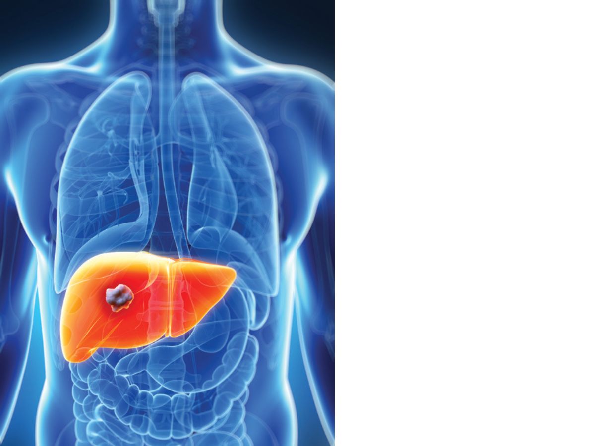 Health Tips know the Liver Cancer Symptoms
